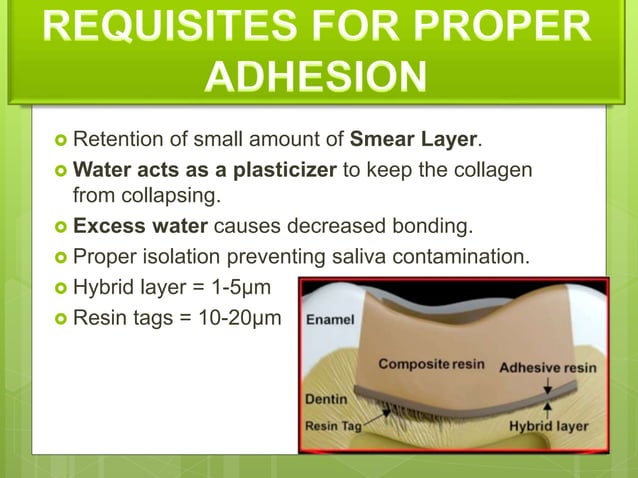 Dentin bonding agents | PPTX