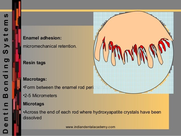 Dentin bonding systems /prosthodontic courses