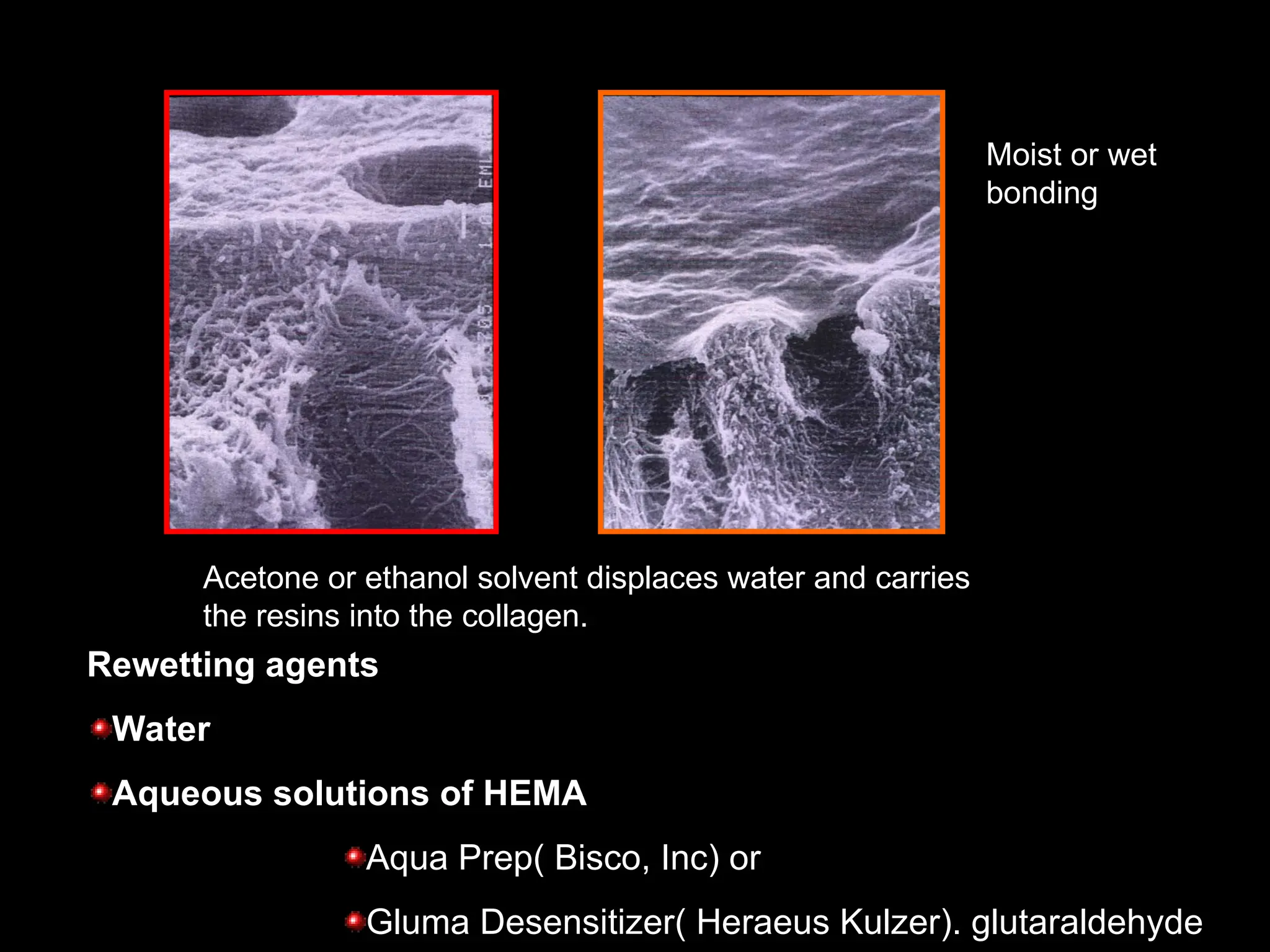 Dentin Bonding Systems in operative dentistry | PPT