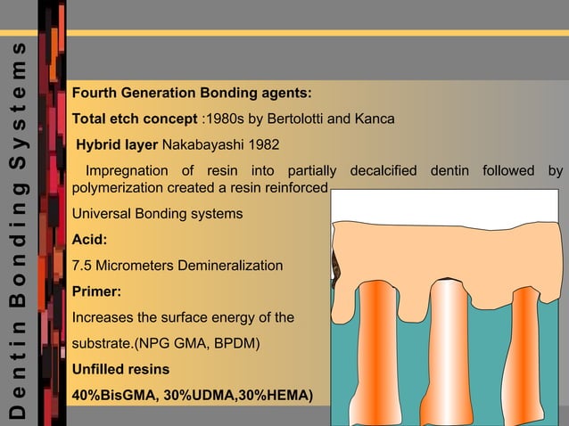 Dentin Bonding Systems in operative dentistry | PPT