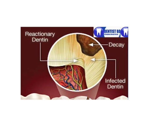 Dentin Development