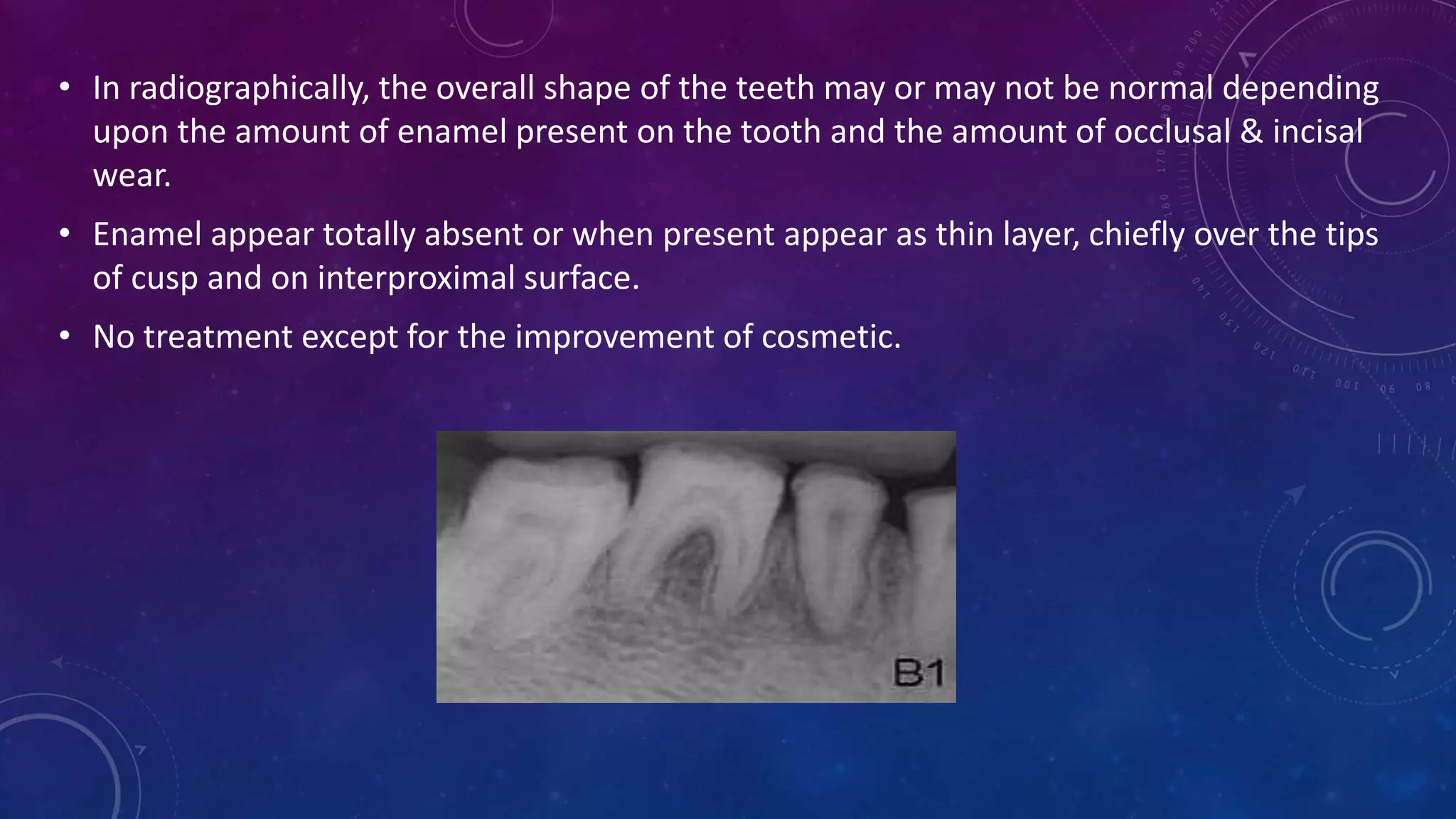 Dentin Dysplasia | PPTX