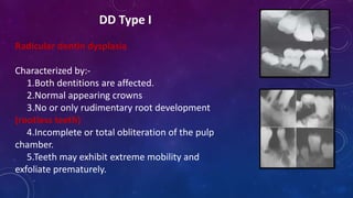 Dentin Dysplasia | PPTX