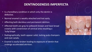 Hereditary Brown Opalescent Dentin Radiograph
