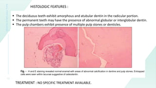 Dentin dysplasia | PPTX