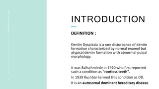 Dentin dysplasia | PPTX
