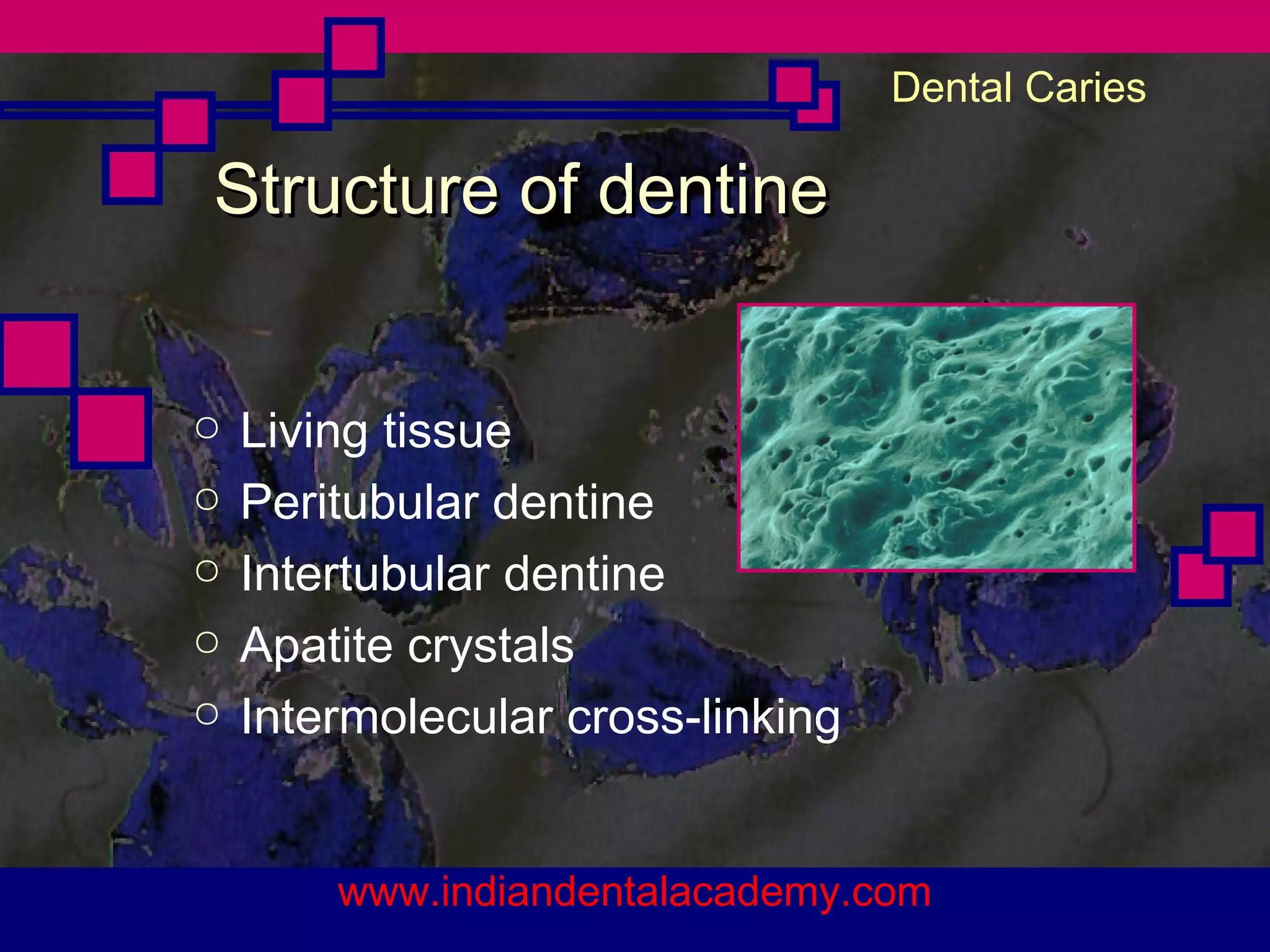 Dental caries progression /certified fixed orthodontic courses by Indian dental academy | PPT