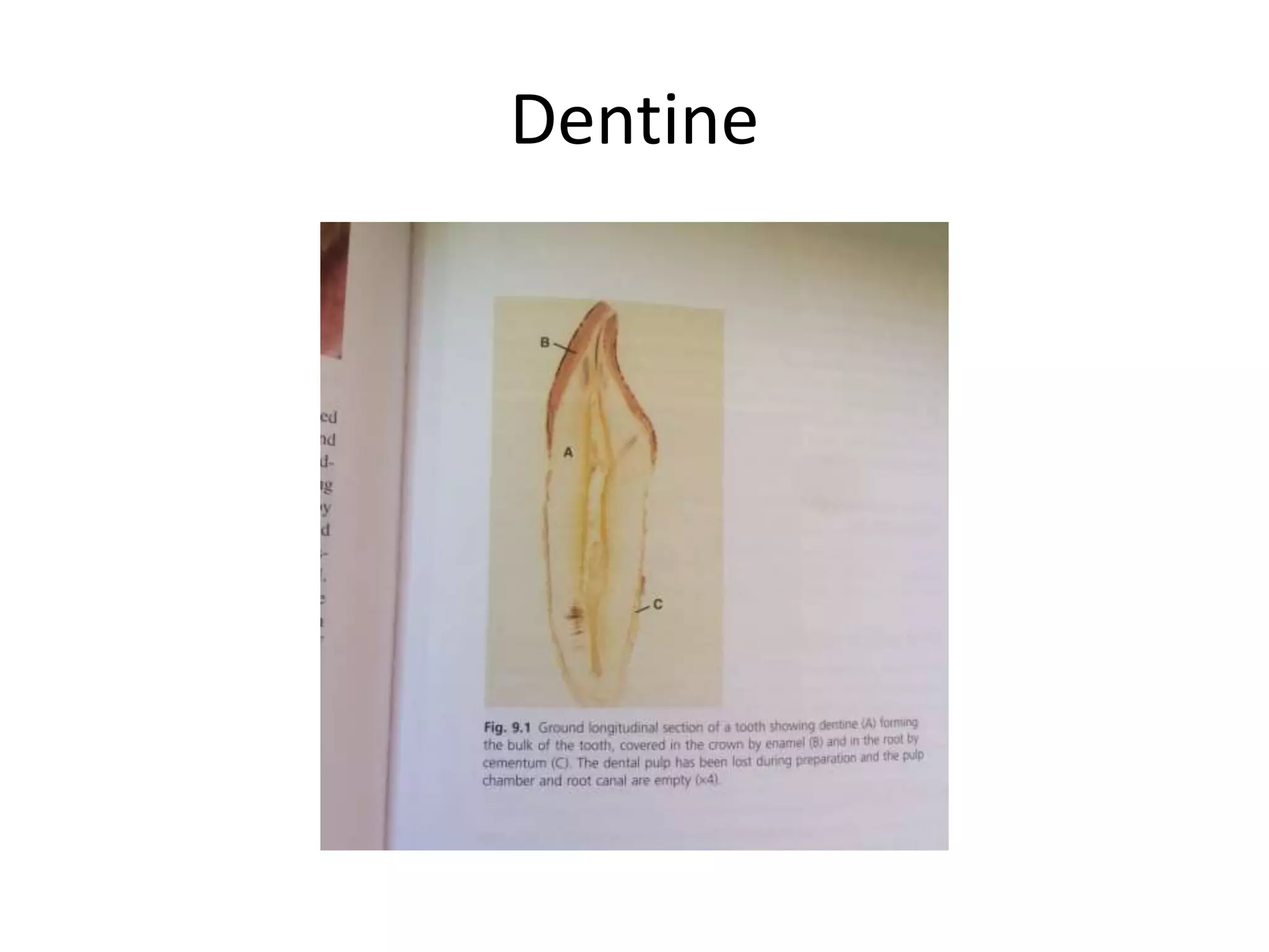 Oral Histology - Dentine | PPTX