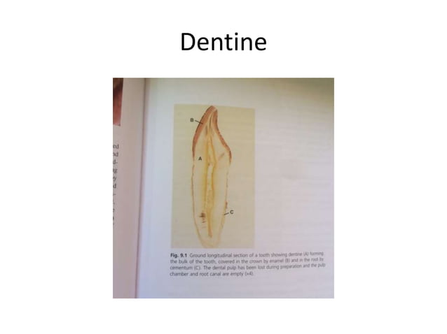 Oral Histology - Dentine | PPTX | Dental Health | Diseases and Conditions