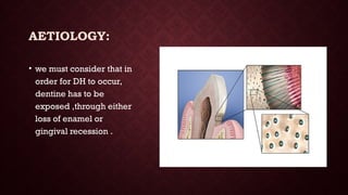 Dentine hypersensitivity and management .pptx
