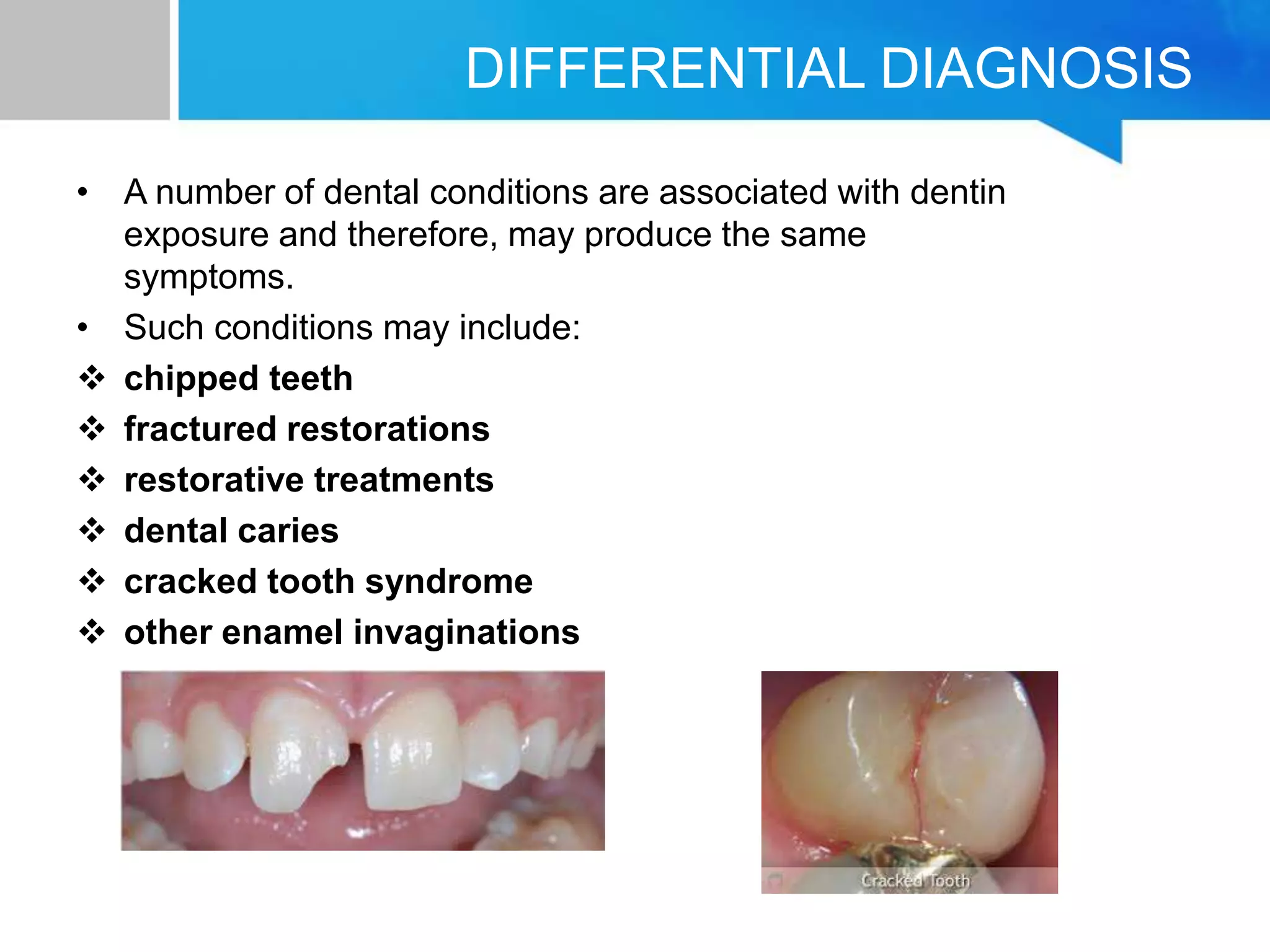 Dentin hypersensitivity | PPTX