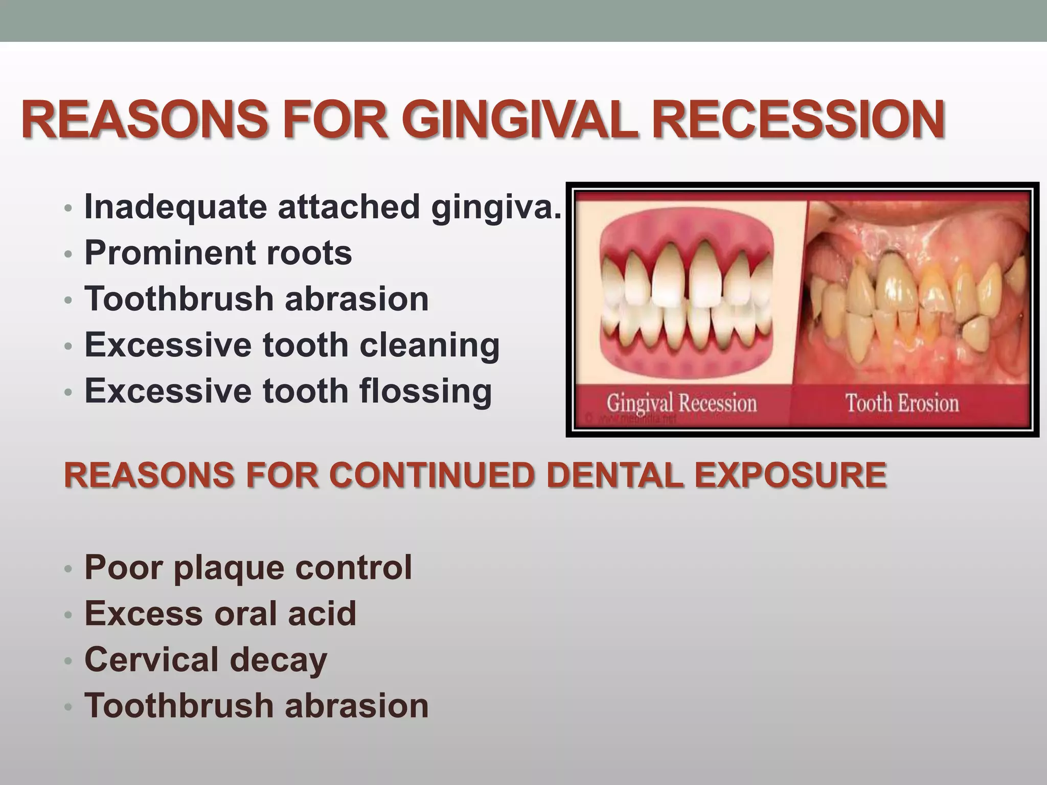 Dentinal hypersenstivity | PPTX