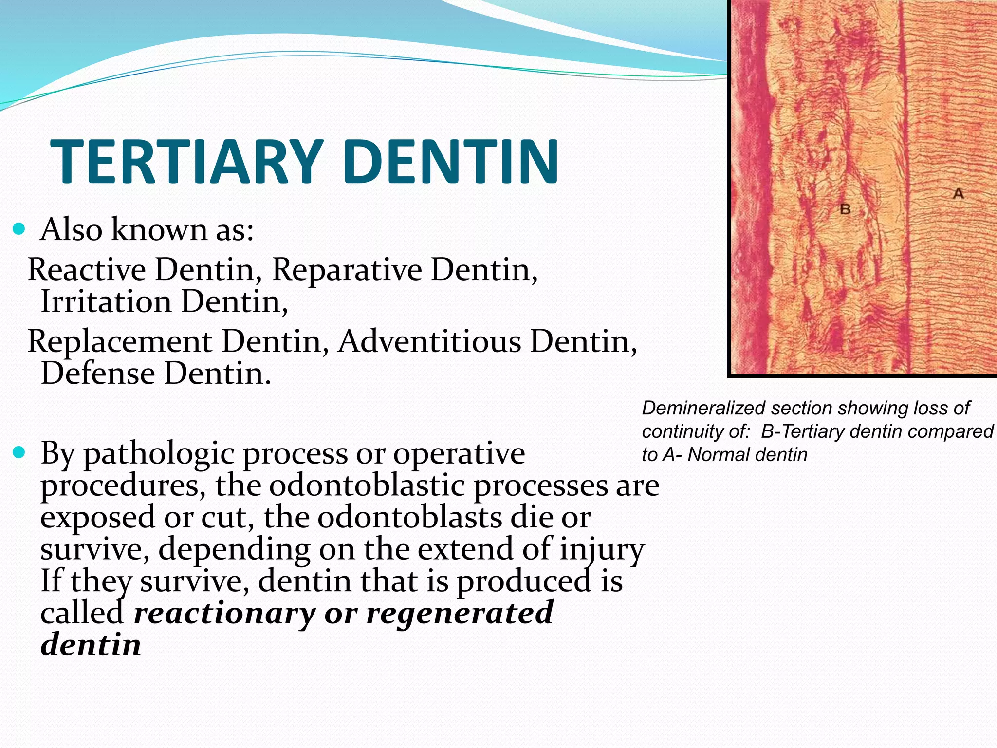 Dentin with emphasis on applied physiology and pathology | PPTX