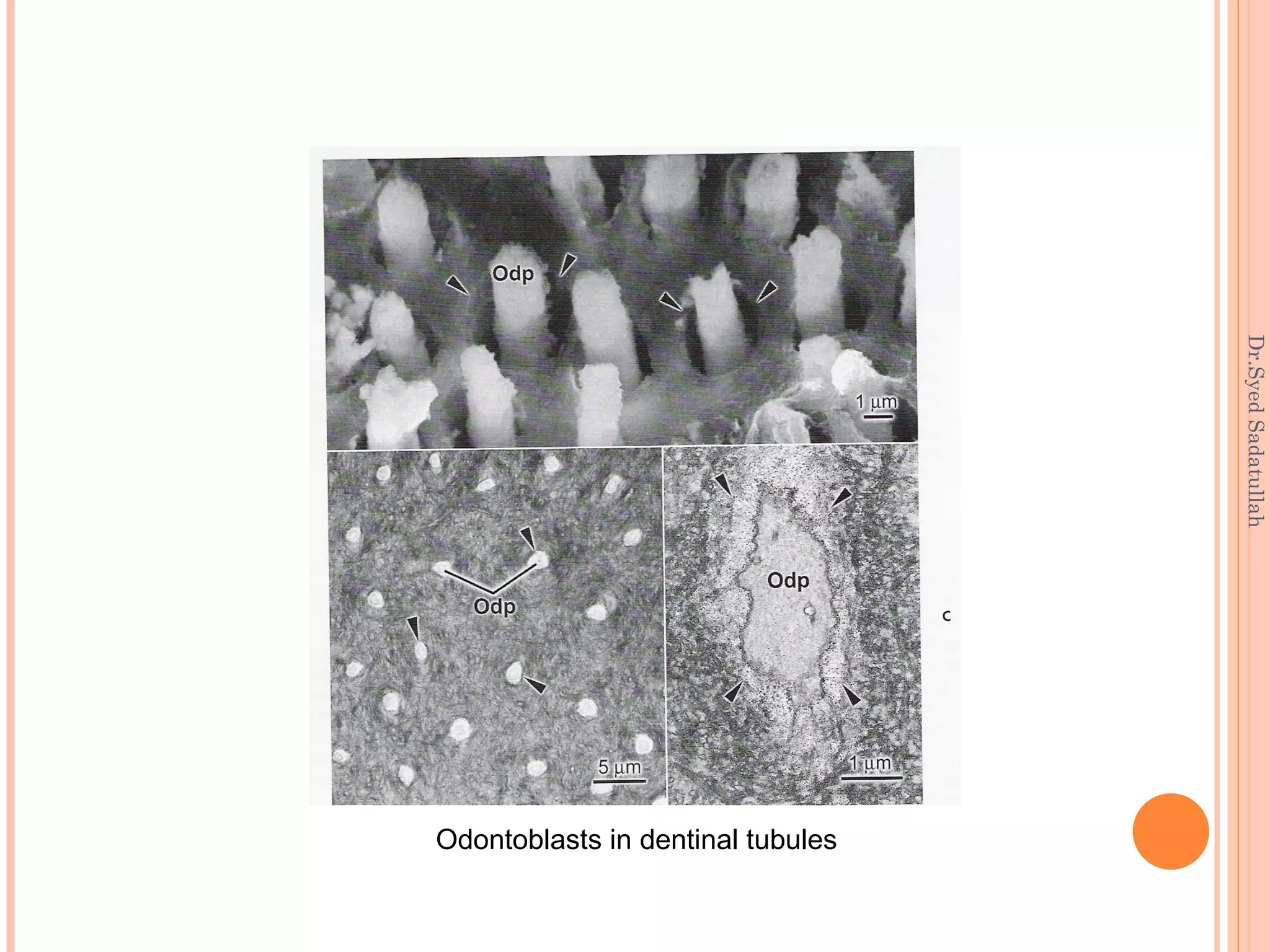 Dentinogenesis | PPT | Dental Health | Diseases and Conditions