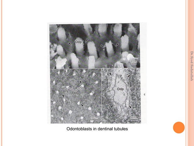Dentinogenesis | PPT | Dental Health | Diseases and Conditions