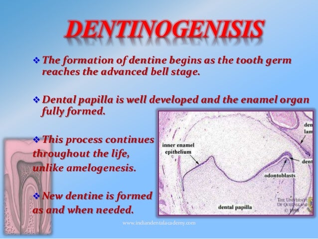 Dentinogenesis/certified fixed orthodontic courses by Indian dental a…