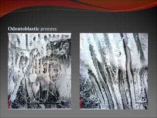 Dentinogenesis | PPT