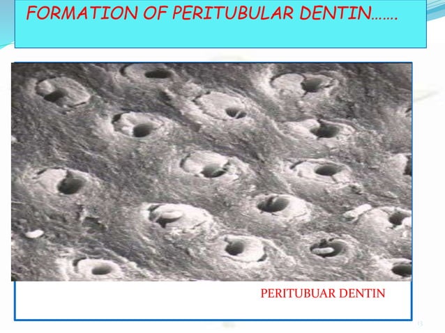 Dentinogenesis & dentin hypersensitivity | PPT