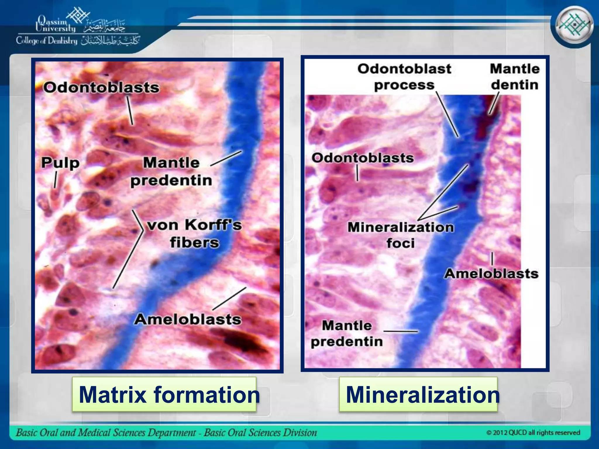 Dentinogenesis & histology of dentin | PPT