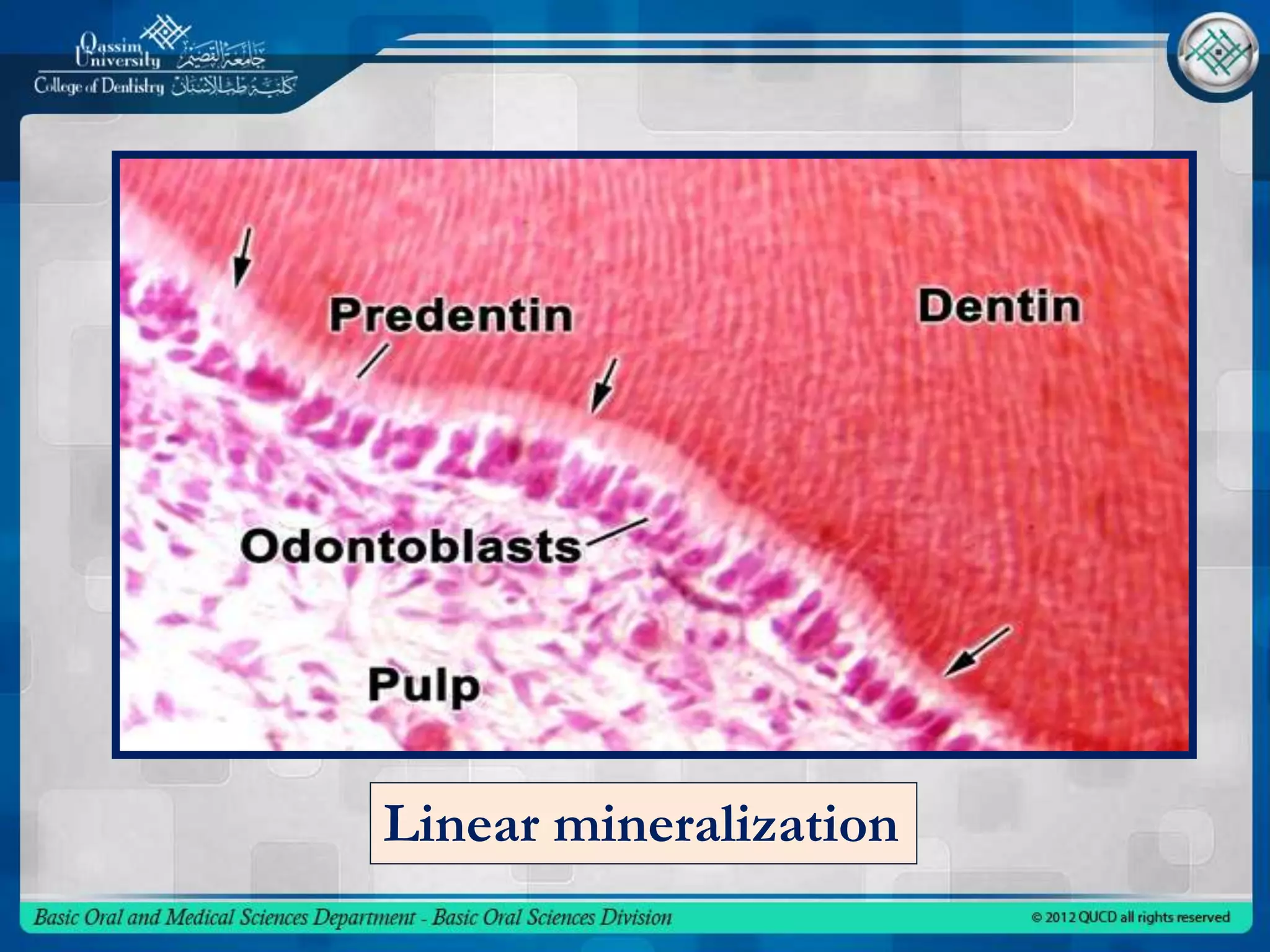 Dentinogenesis & histology of dentin | PPT