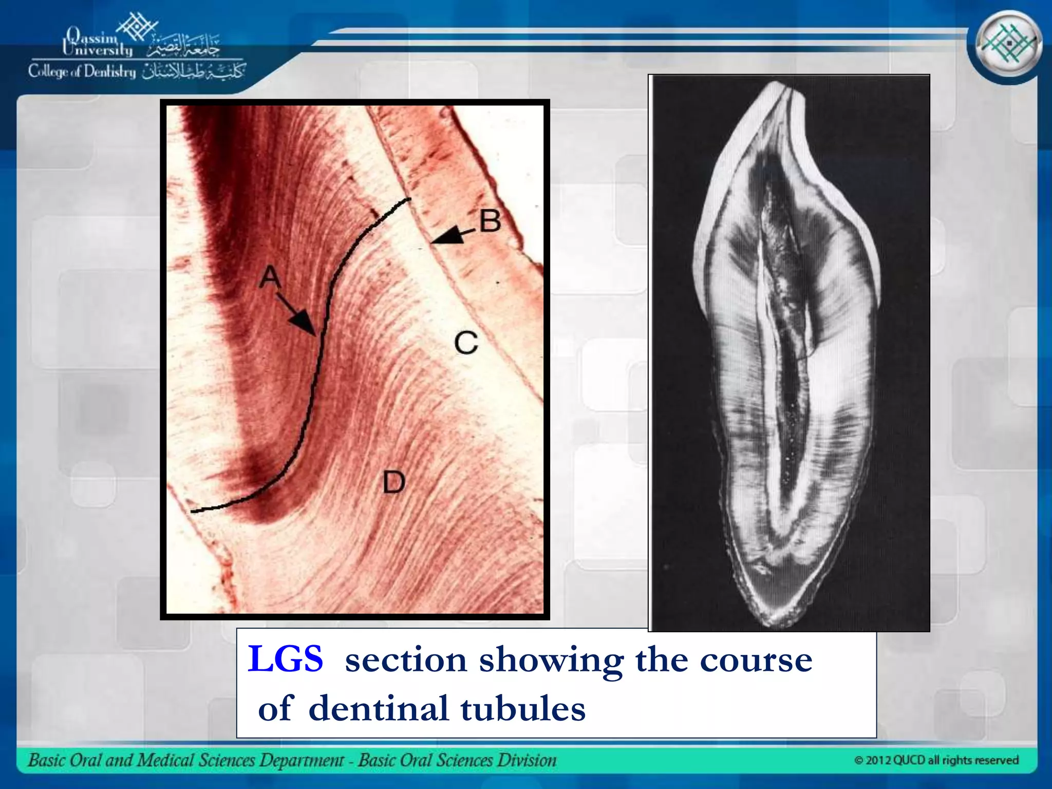Dentinogenesis & histology of dentin | PPT
