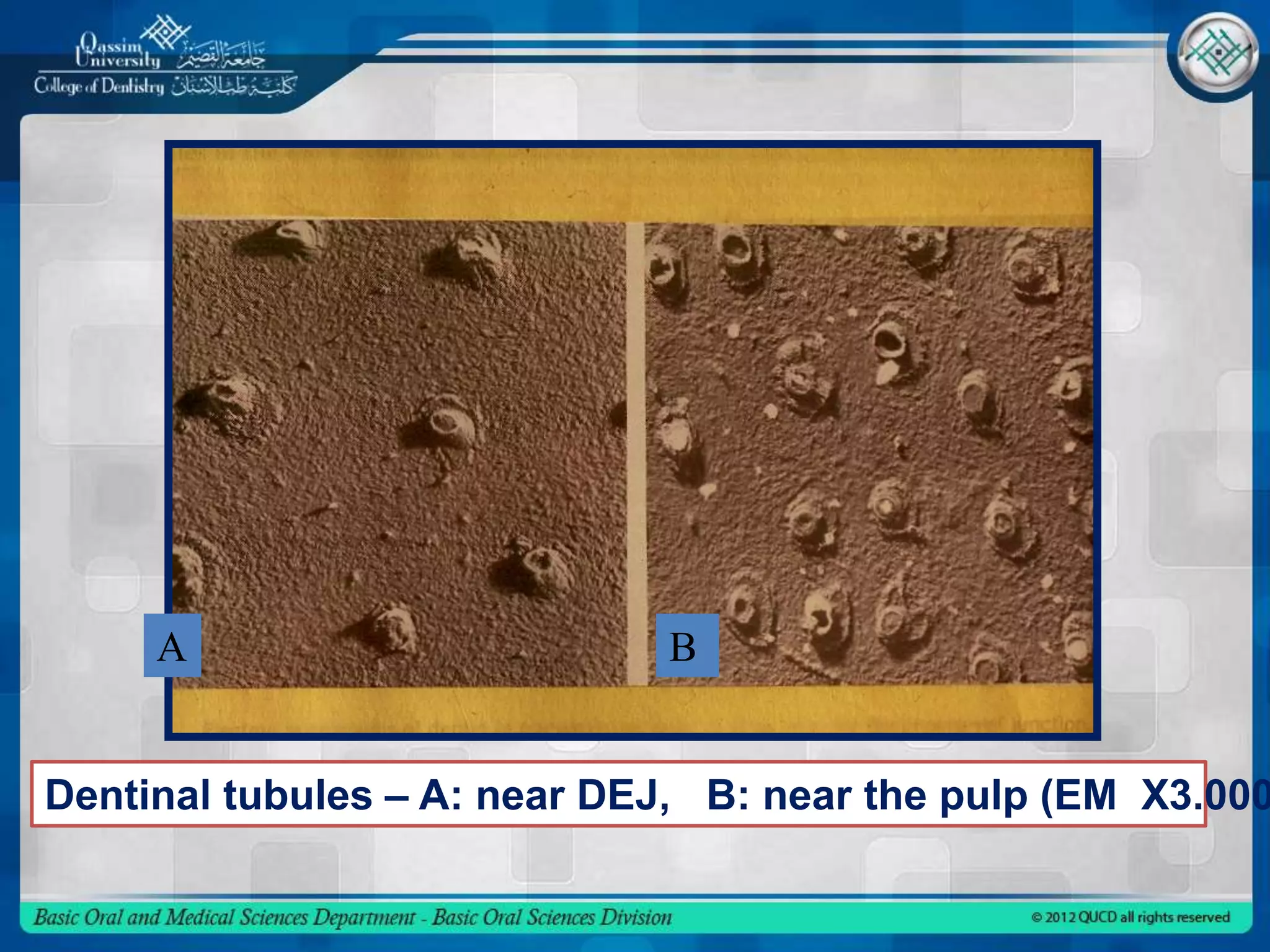 Dentinogenesis & histology of dentin | PPT