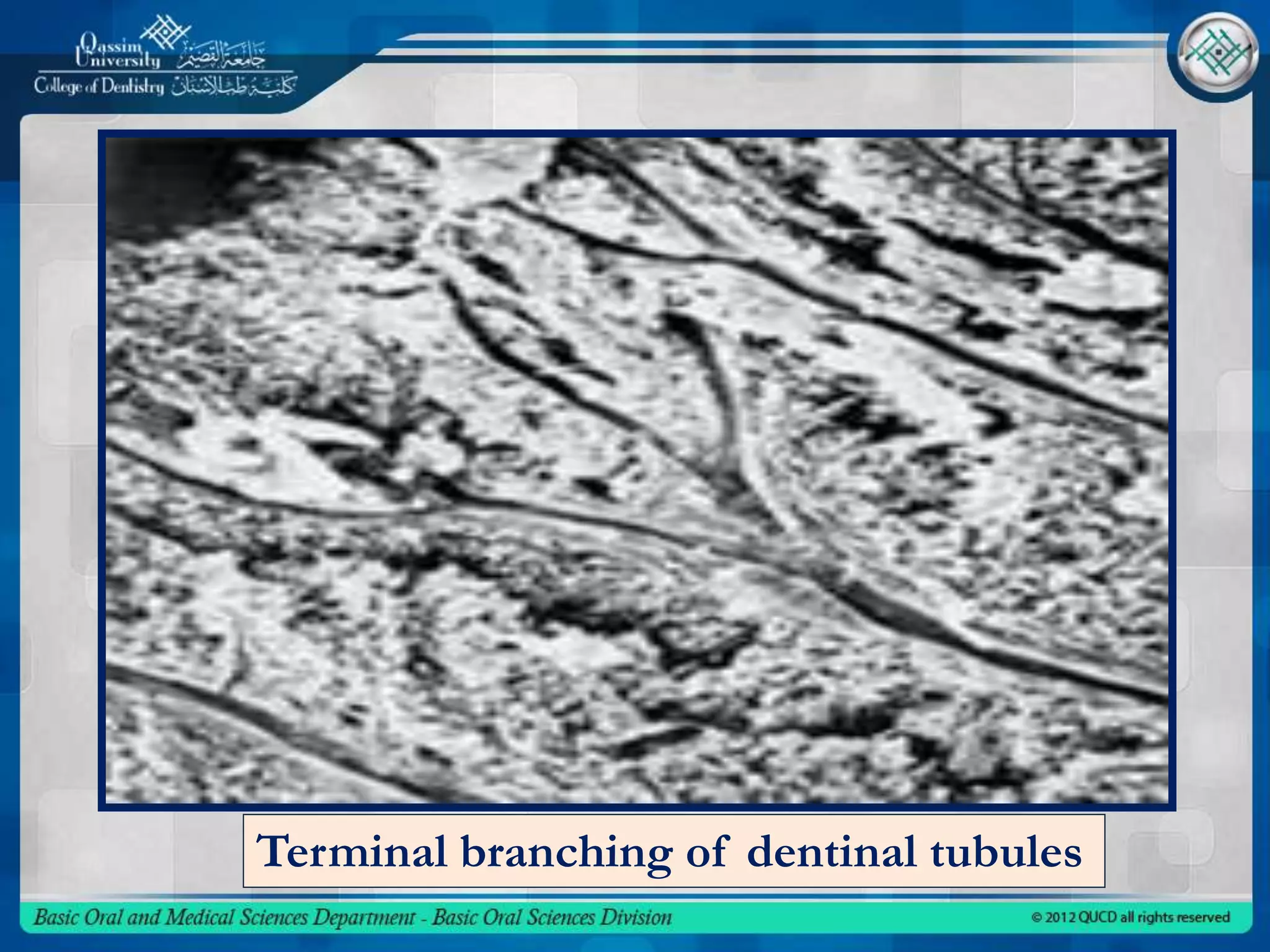 Dentinogenesis & histology of dentin | PPT