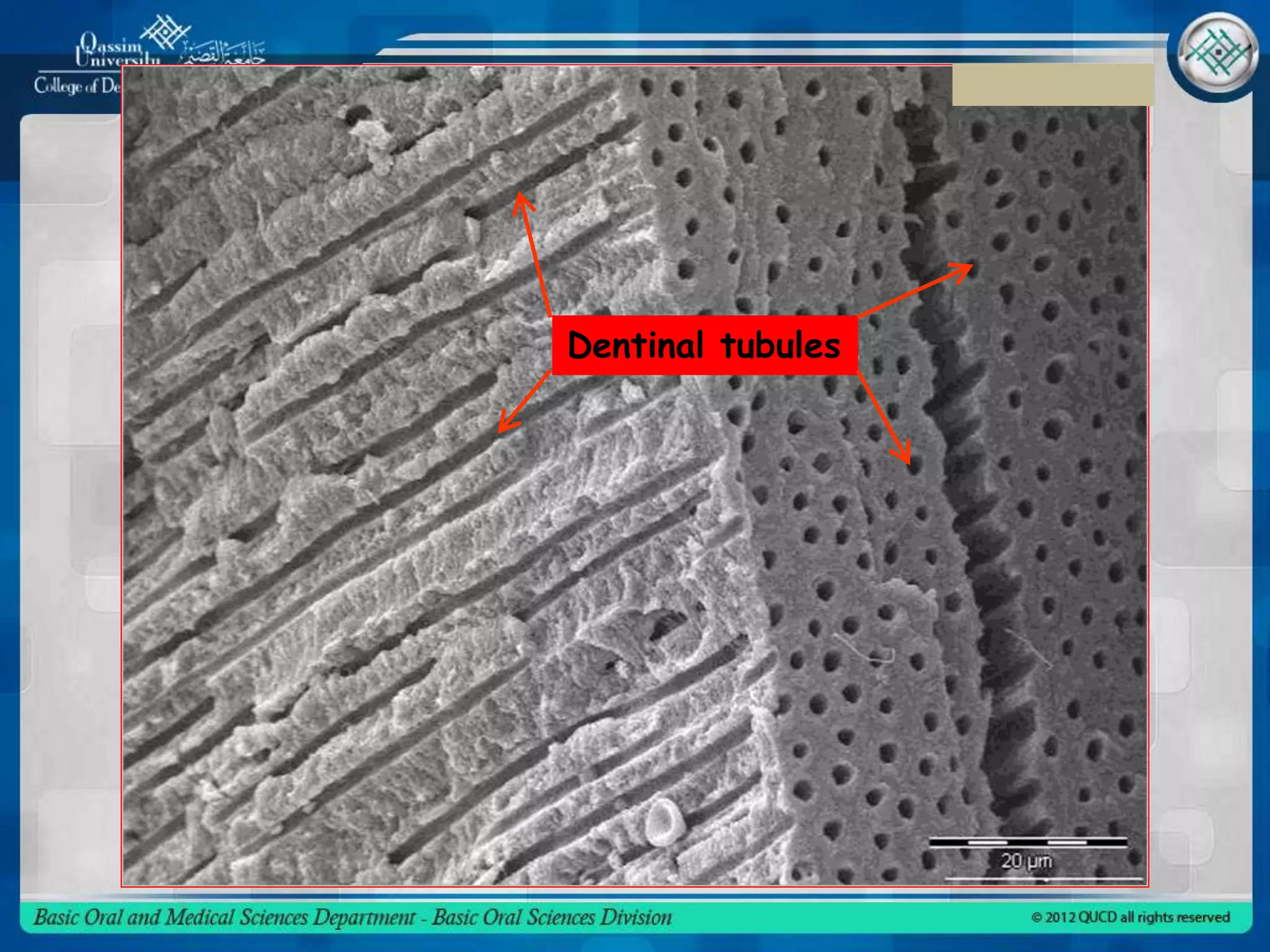 Dentinogenesis & histology of dentin | PPT
