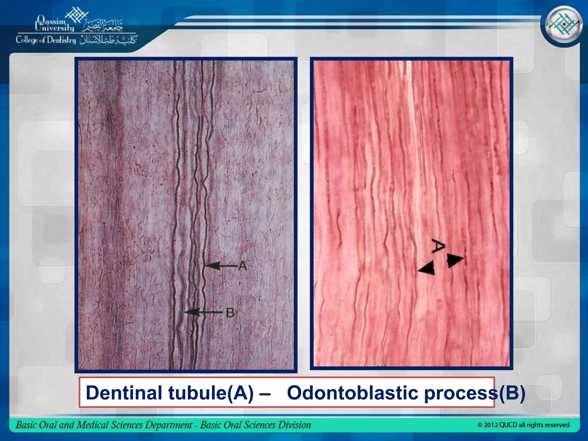 Dentinogenesis & histology of dentin | PPT