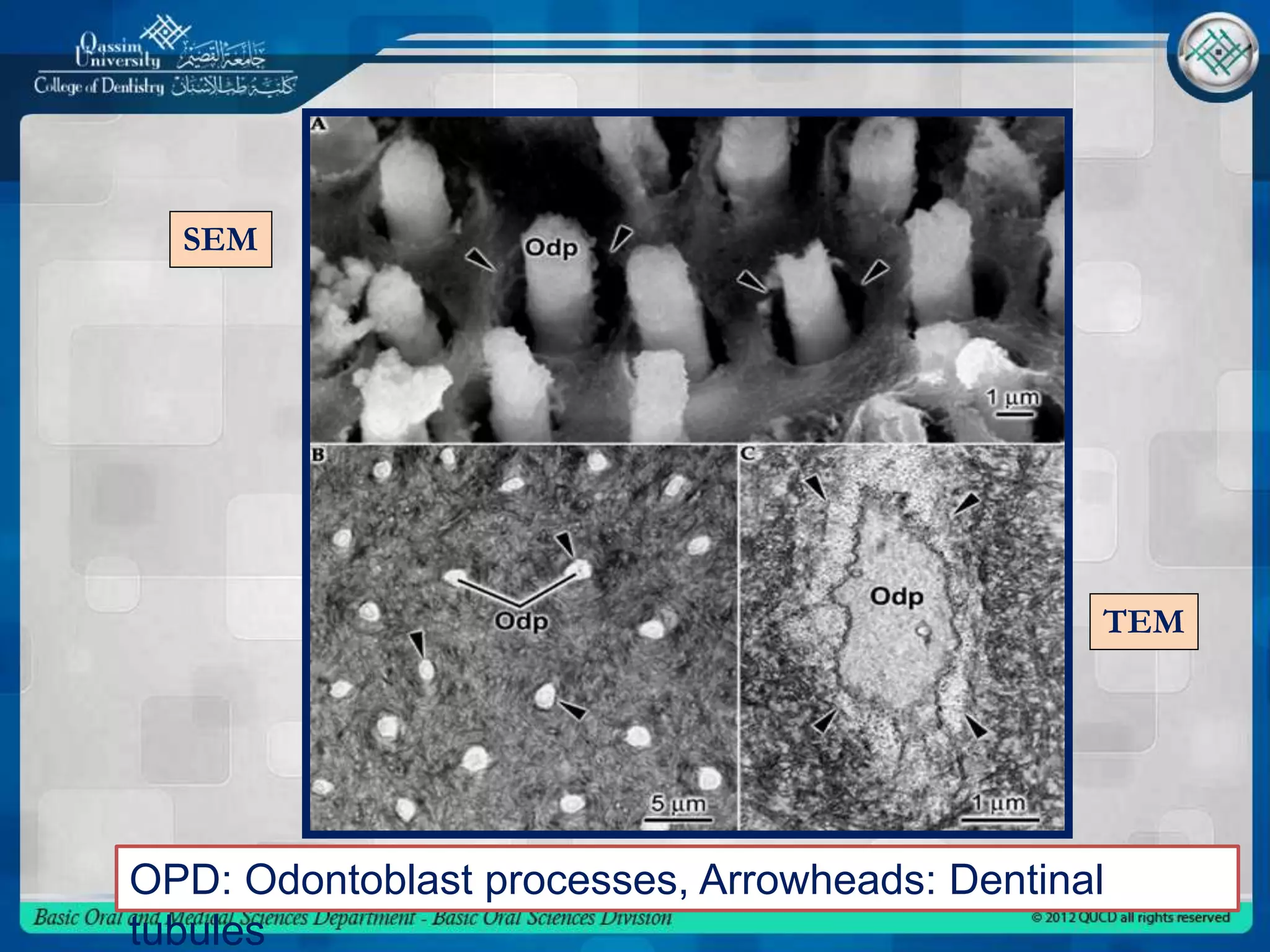 Dentinogenesis & histology of dentin | PPT
