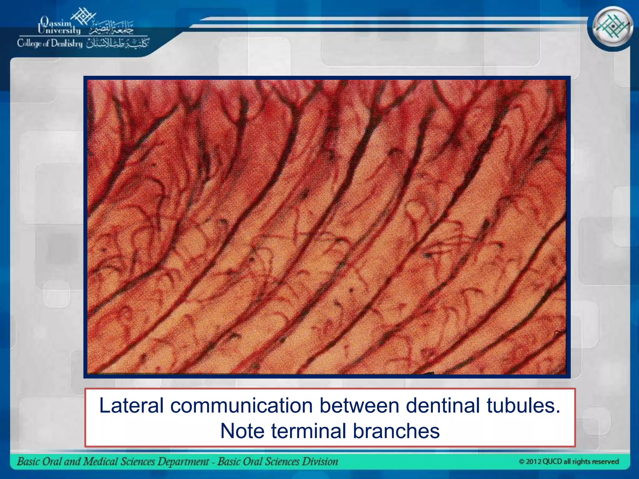 Dentinogenesis & histology of dentin | PPT