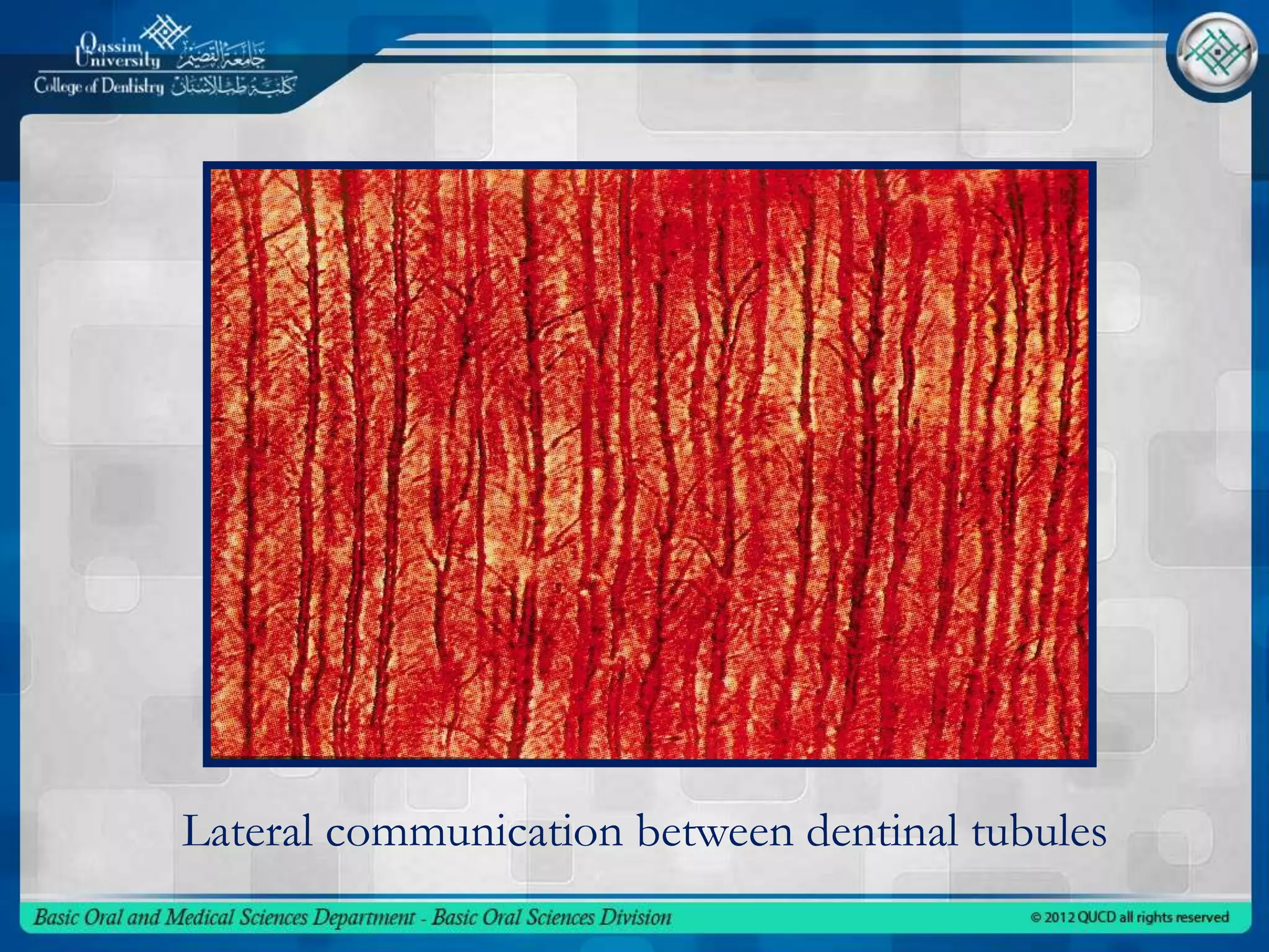 Dentinogenesis & histology of dentin | PPT