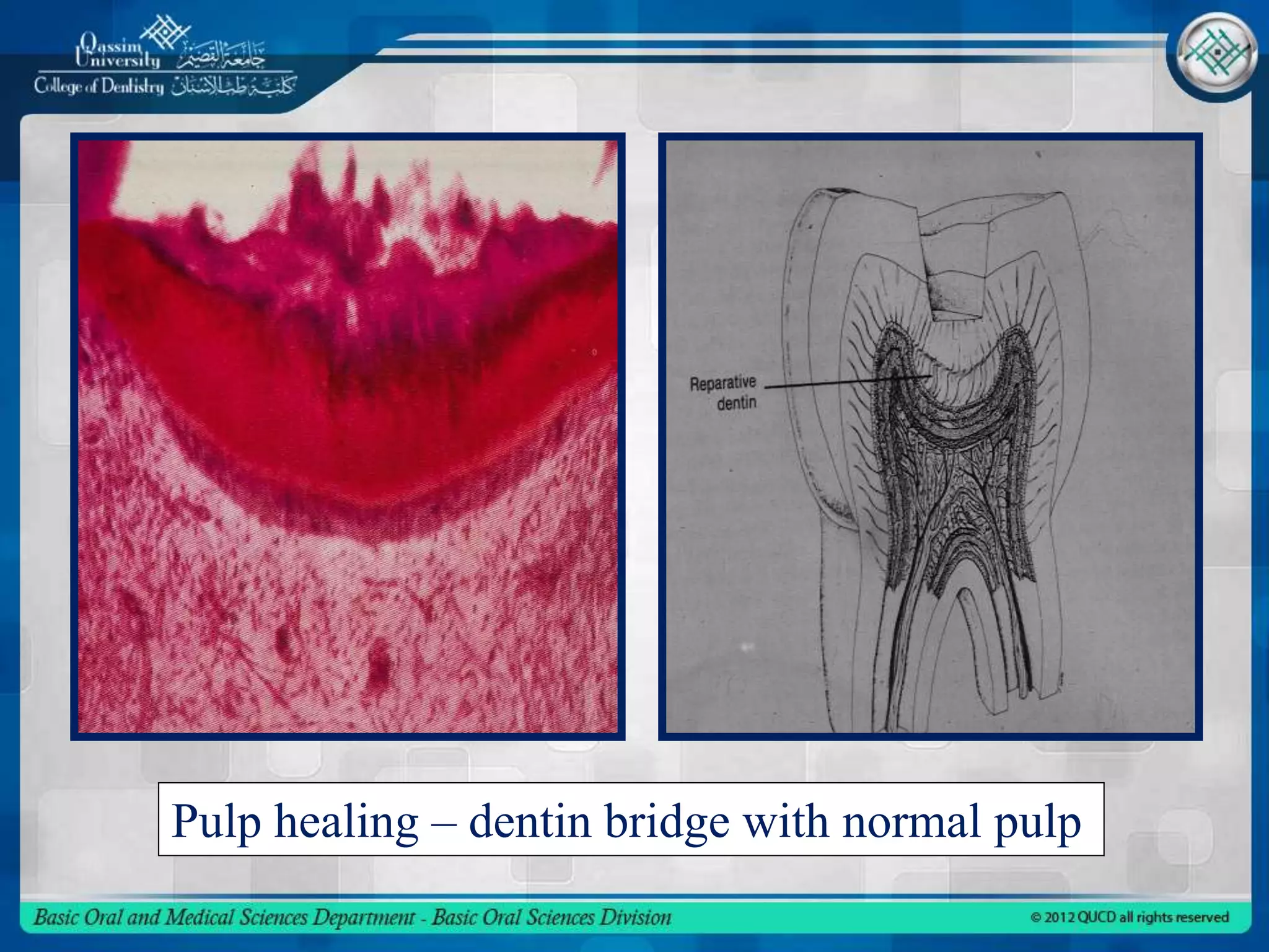 Dentinogenesis & histology of dentin | PPT
