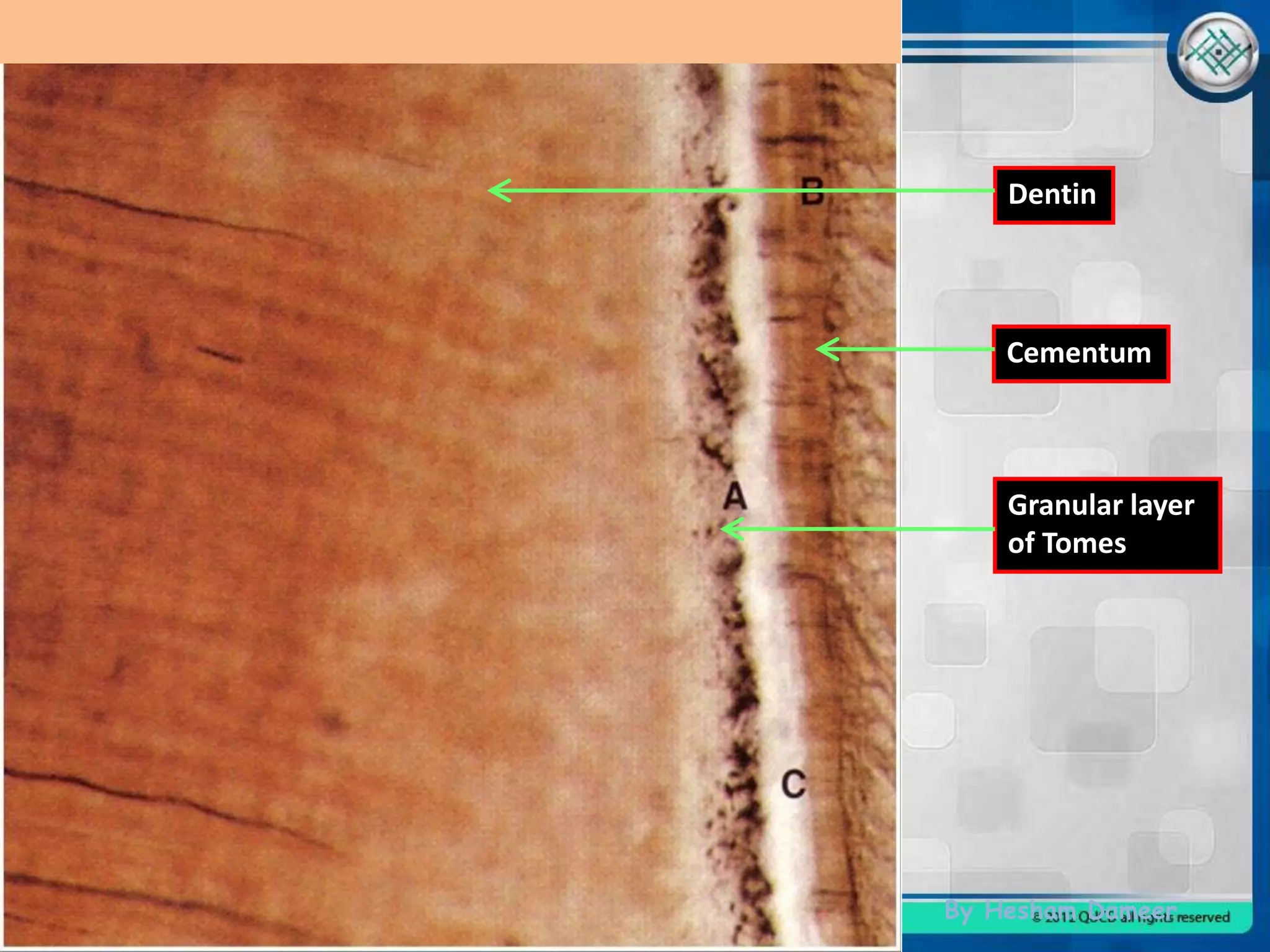 Dentinogenesis & histology of dentin | PPT