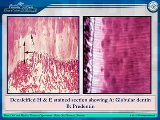 Dentinogenesis & histology of dentin | PPT
