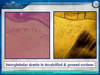 Dentinogenesis & histology of dentin | PPT