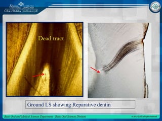 Dentinogenesis & histology of dentin | PPT