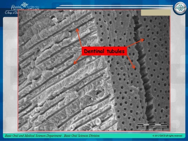 Dentinogenesis & histology of dentin