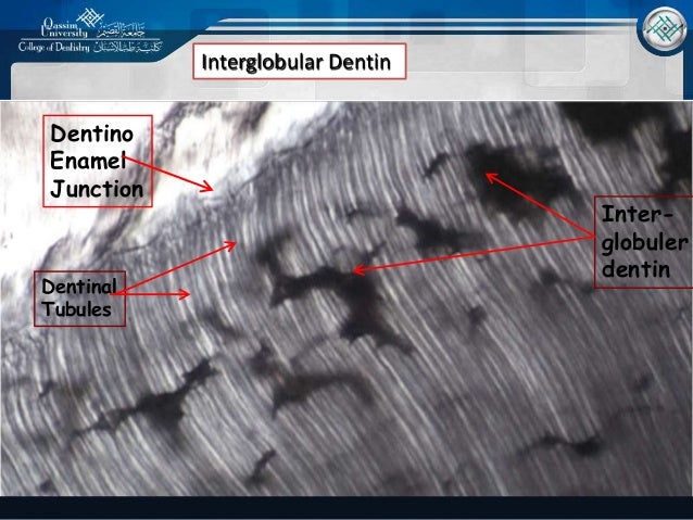 Dentinogenesis & histology of dentin