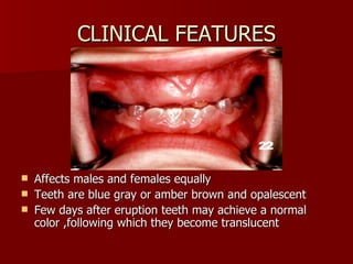 Dentinogenesis Imperfecta | PPT