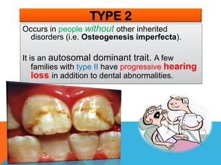 Dentinogenesis imperfecta | PPTX
