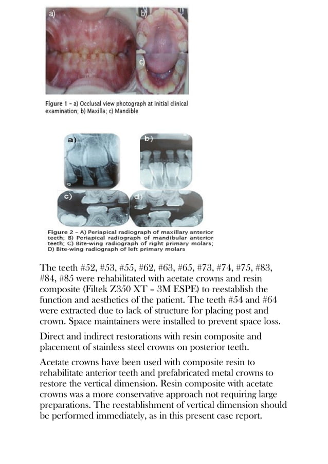 DENTINOGENESIS IMPERFECTA in adult tooth | PDF