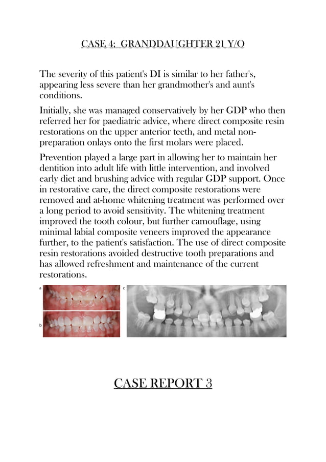 DENTINOGENESIS IMPERFECTA in adult tooth | PDF