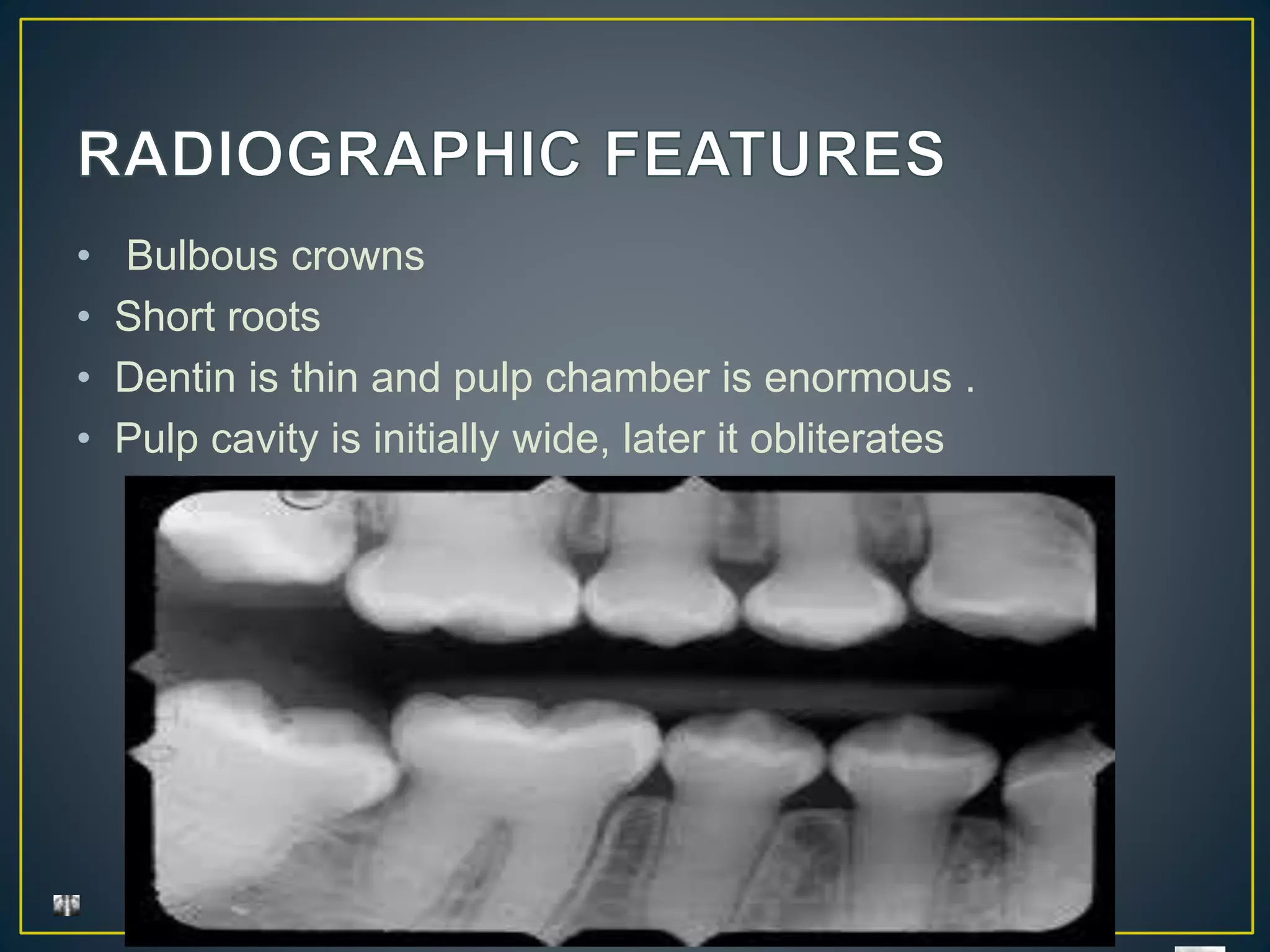Dentinogenesis imperfecta tamale | PPT