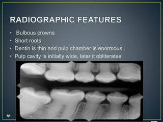 Dentinogenesis Imperfecta Tamale Pptx