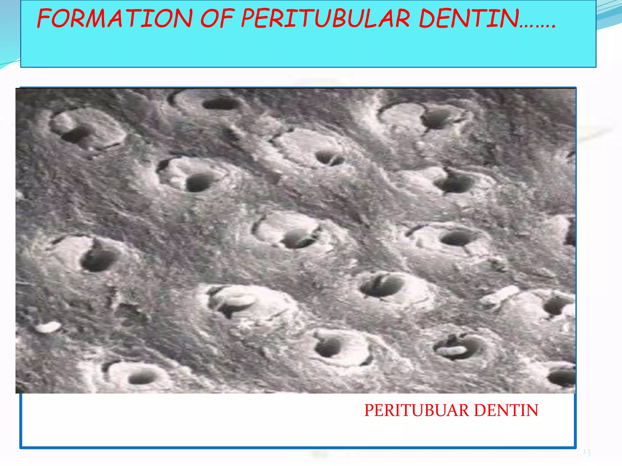 DENTINOGENESIS & DENTIN HYPERSENSITIVITY | PPTX