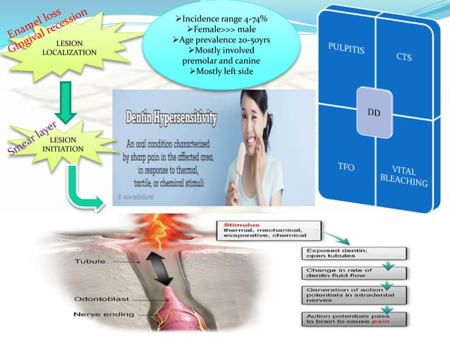 DENTINOGENESIS & DENTIN HYPERSENSITIVITY | PPTX | Dental Health | Diseases and Conditions