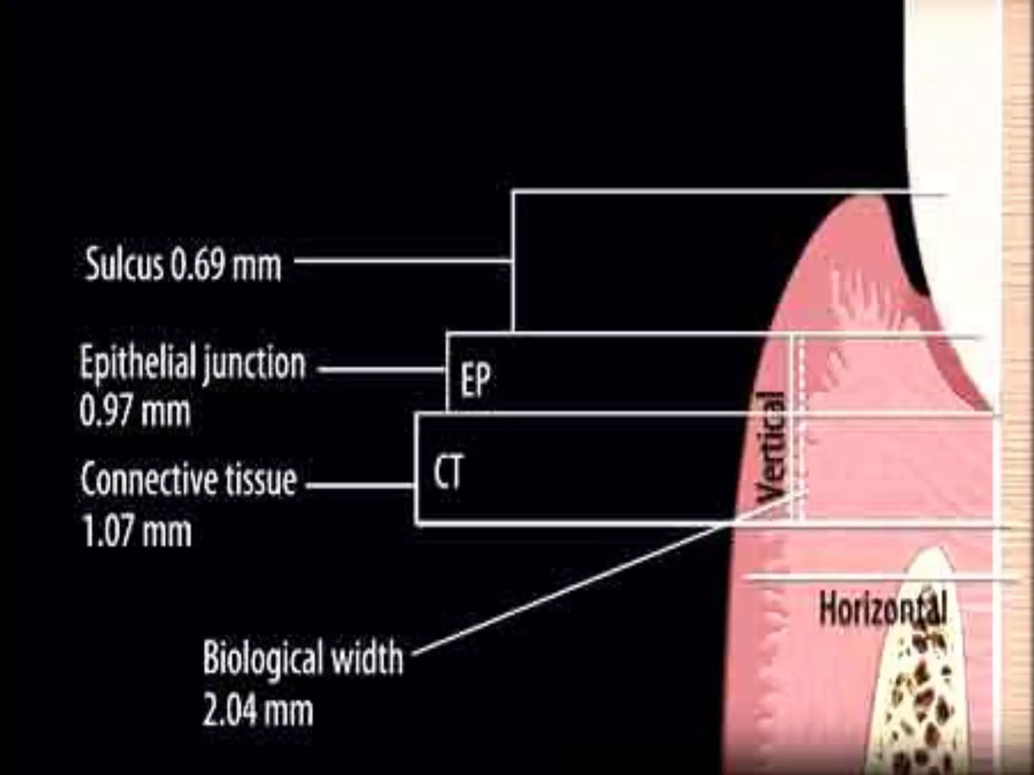 Dentinogingival junction | PPTX