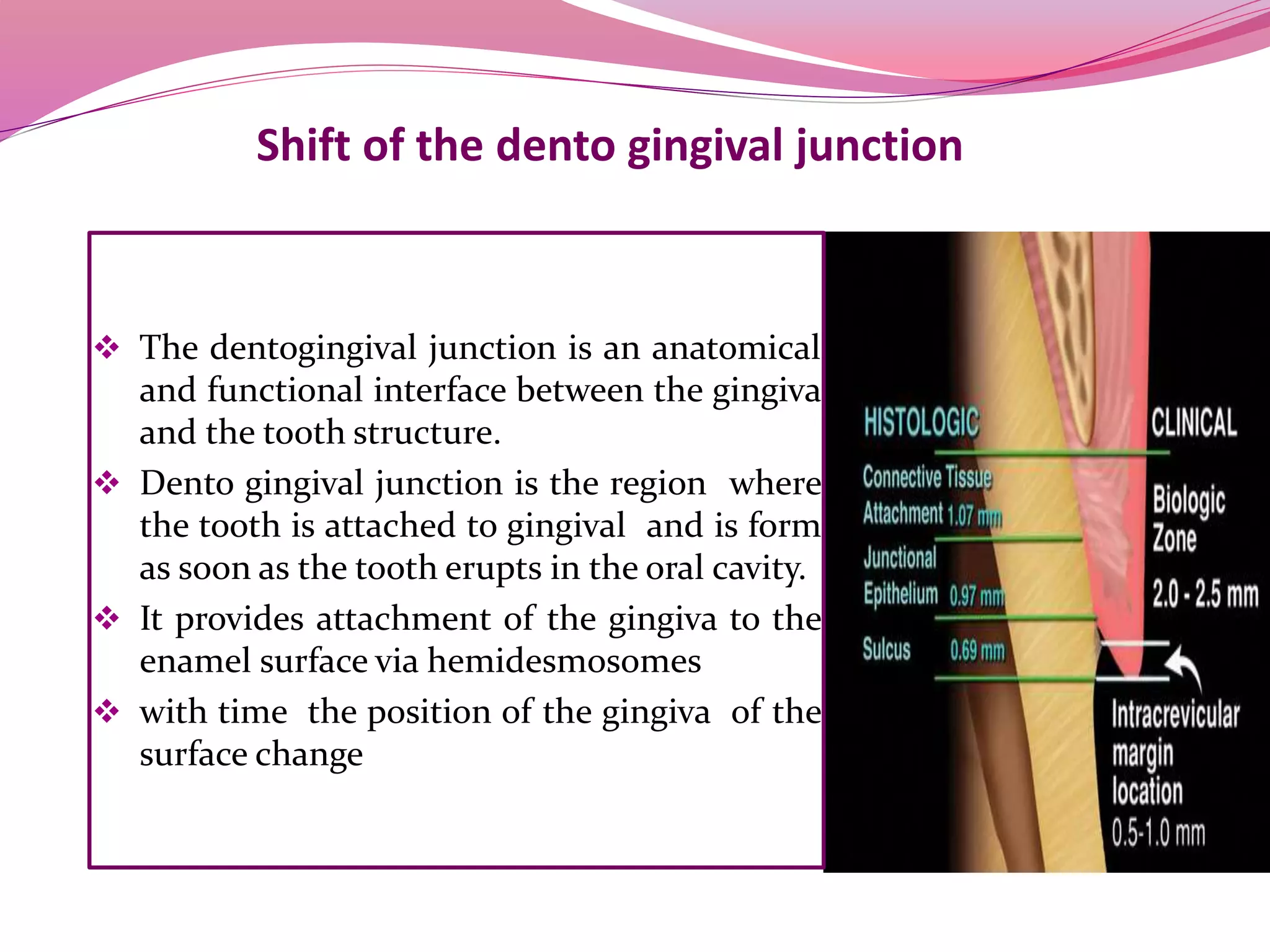Dentinogingival junction | PPTX