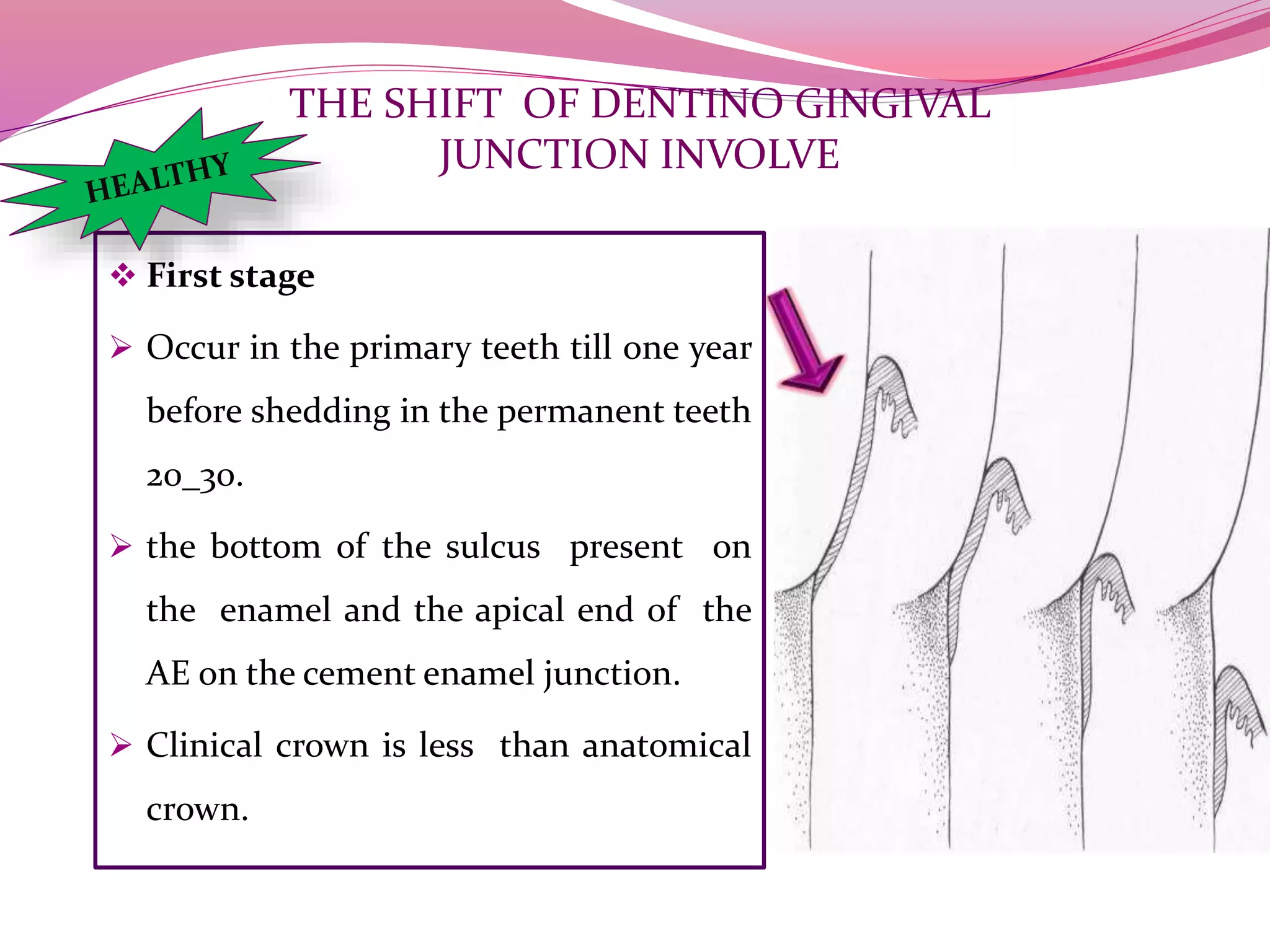 Dentinogingival junction | PPTX